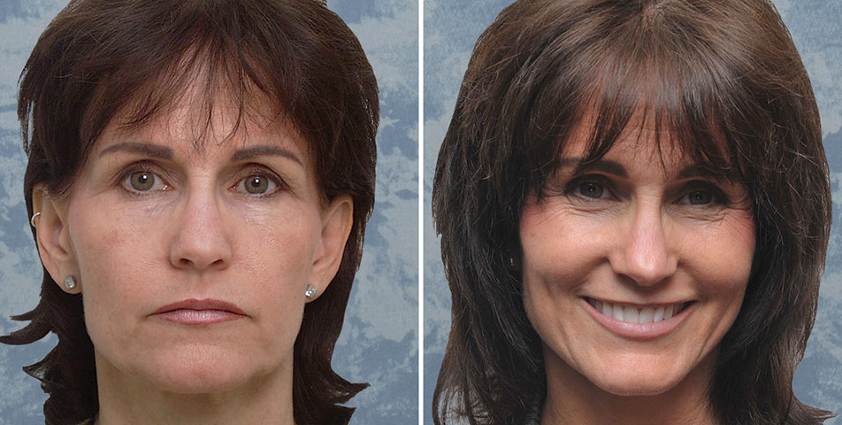 Plastic Surgeon Dallas and Plano Texas area – Roberts Cosmetic Surgery